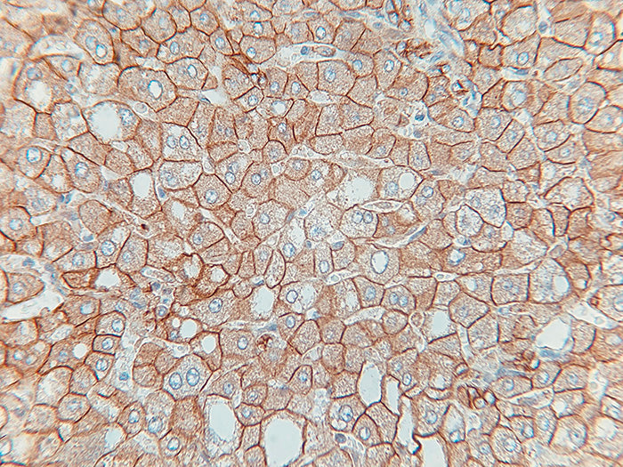 E-Cadherin – Control Dx