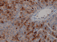 Alpha Fetoprotein (AFP) – Control Dx